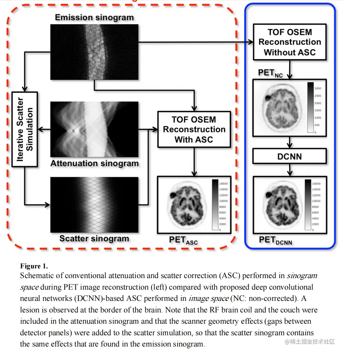 PET-AI讲解 | 脑部专用PET相关论文： Joint Correction of Attenuation and - 掘金